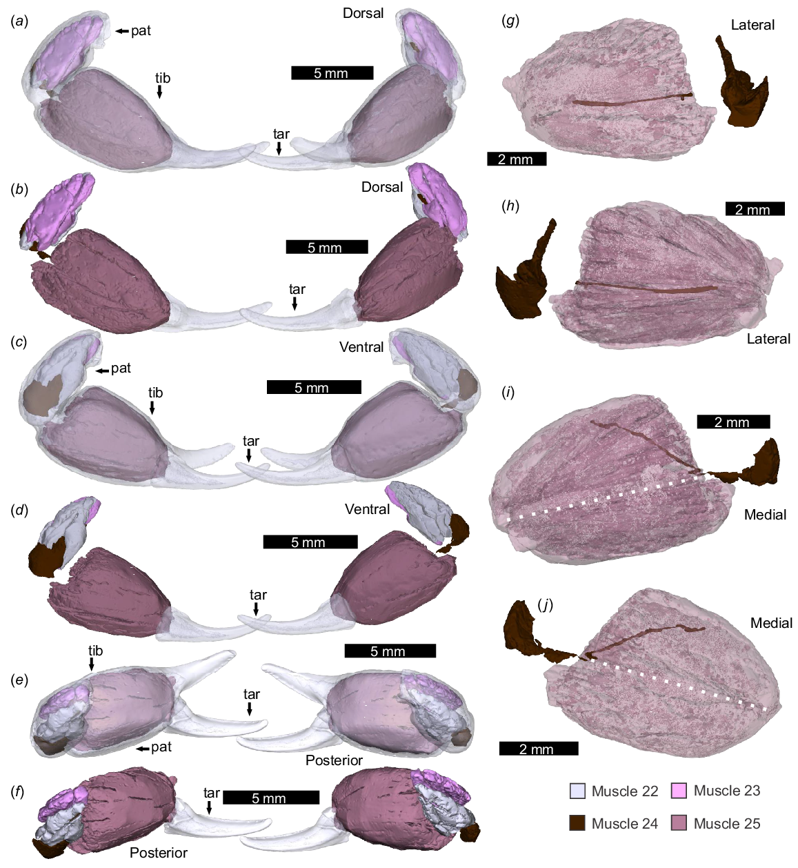 Pedipalp anatomy of the Australian black rock scorpion, Urodacus ...