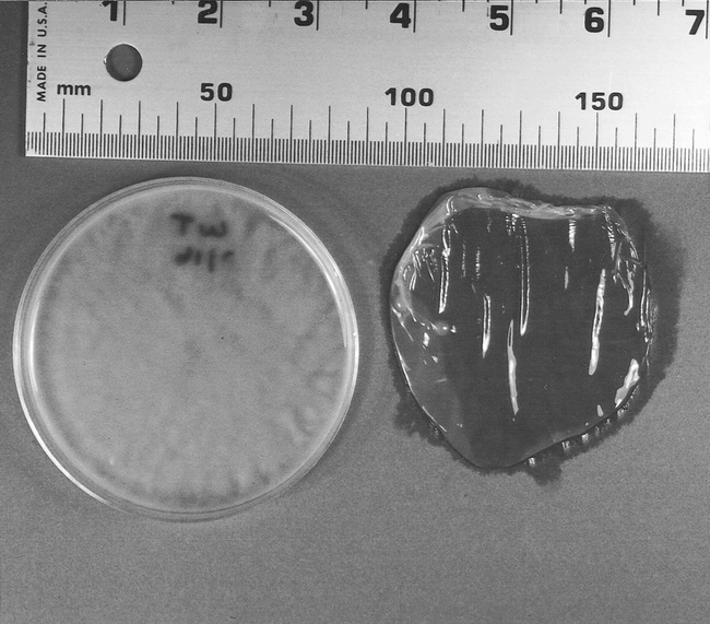 Acetobacter xylinum: An Inquiry into Cellulose Biosynthesis