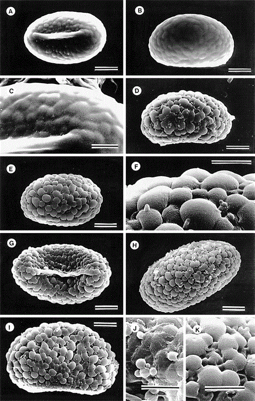 Spore Morphology of the Polypodiaceae from Northwestern Argentina