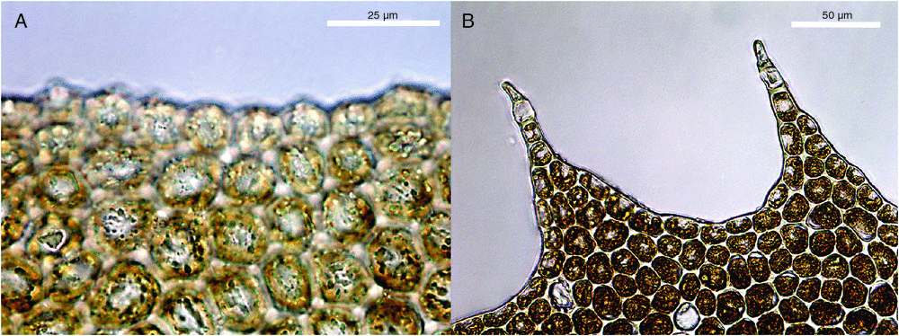 A revision of Australian species of Radula subg. Odontoradula