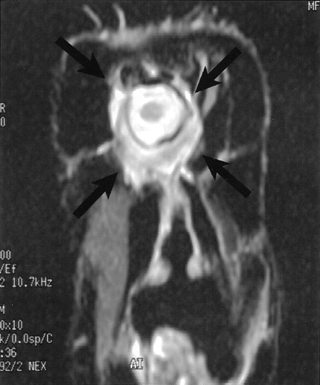 Magnetic Resonance Imaging in Psittacine Birds with Chronic Sinusitis