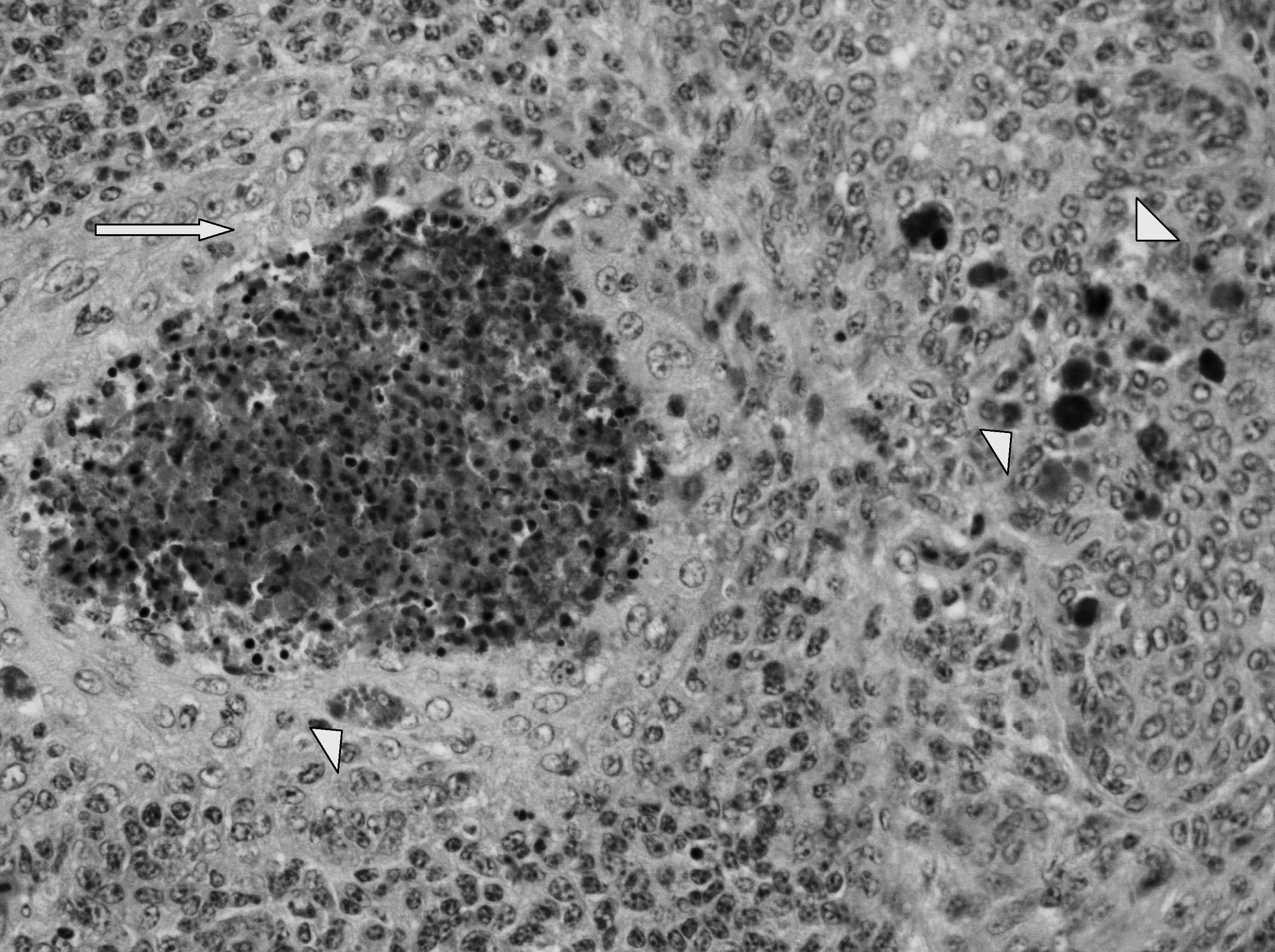 Effect of a Commercial Paratyphus Vaccine on the Development of Pigeon ...