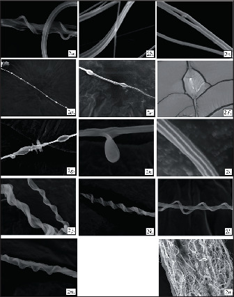 Spider Silk Structures as Seen with a Scanning Electron Microscope