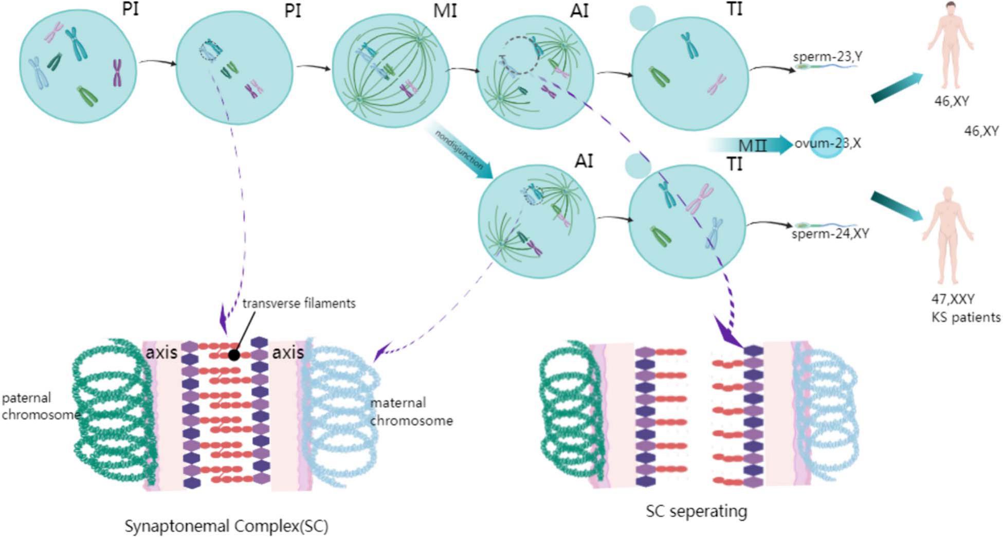 Klinefelter syndrome: etiology and clinical considerations in male ...