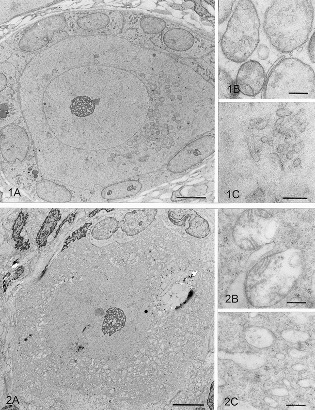 Ultrastructure of the Resting Ovarian Follicle Pool in Healthy Young Women1