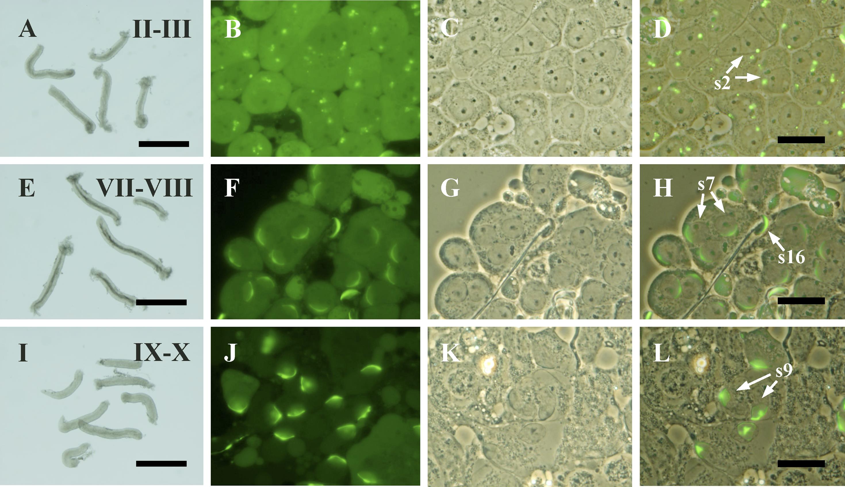 Functional Analysis of Male Mouse Haploid Germ Cells of Various ...