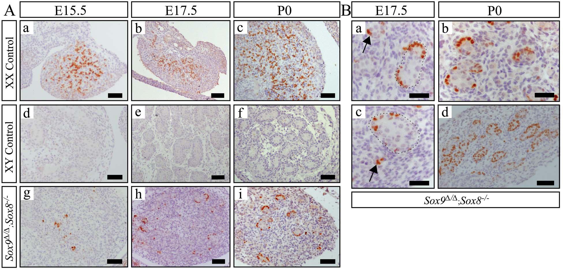 Sox9 and Sox8 Are Required for Basal Lamina Integrity of Testis Cords ...