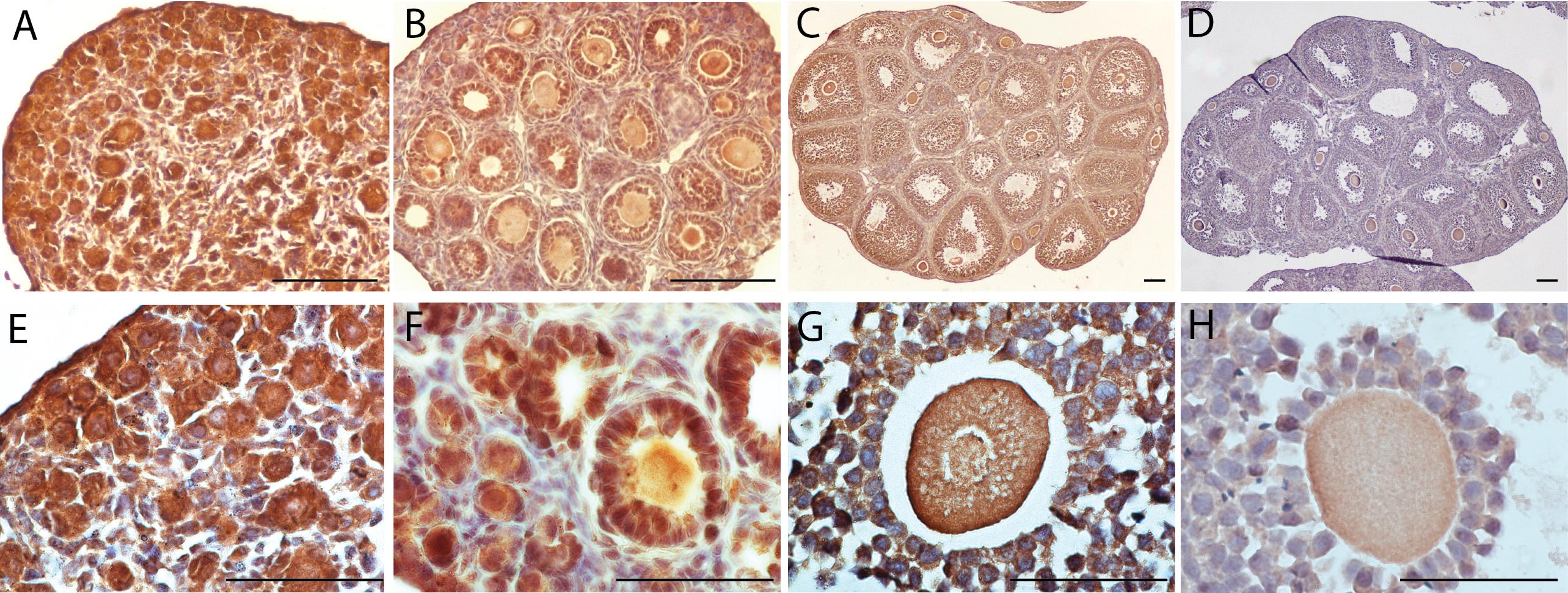 Lats1 Deletion Causes Increased Germ Cell Apoptosis and Follicular ...