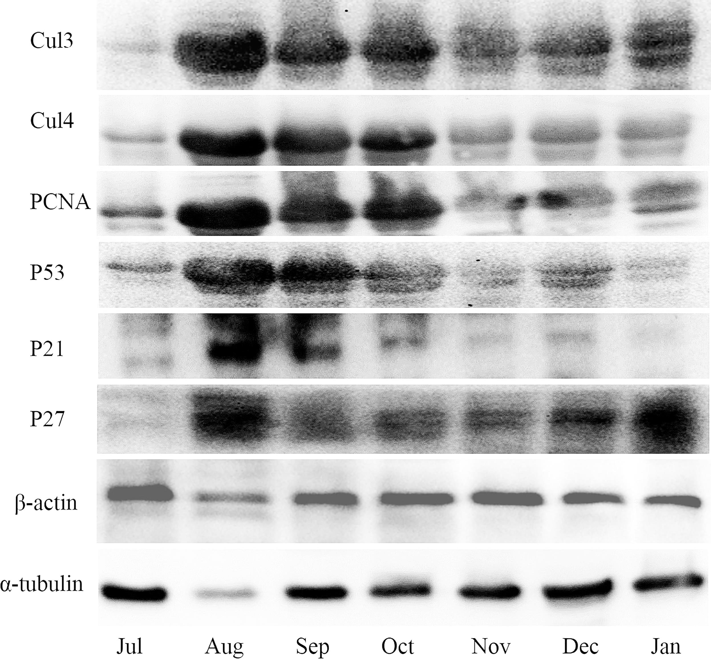 The E3 Ubiquitin Ligase CRL4 Regulates Proliferation and Progression ...