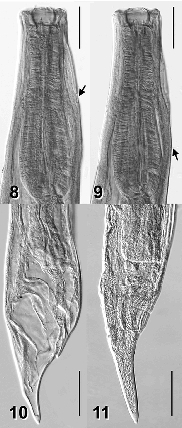 Morphology and Diagnosis of Fourth-Stage Larvae of Tridentoinfundibulum ...