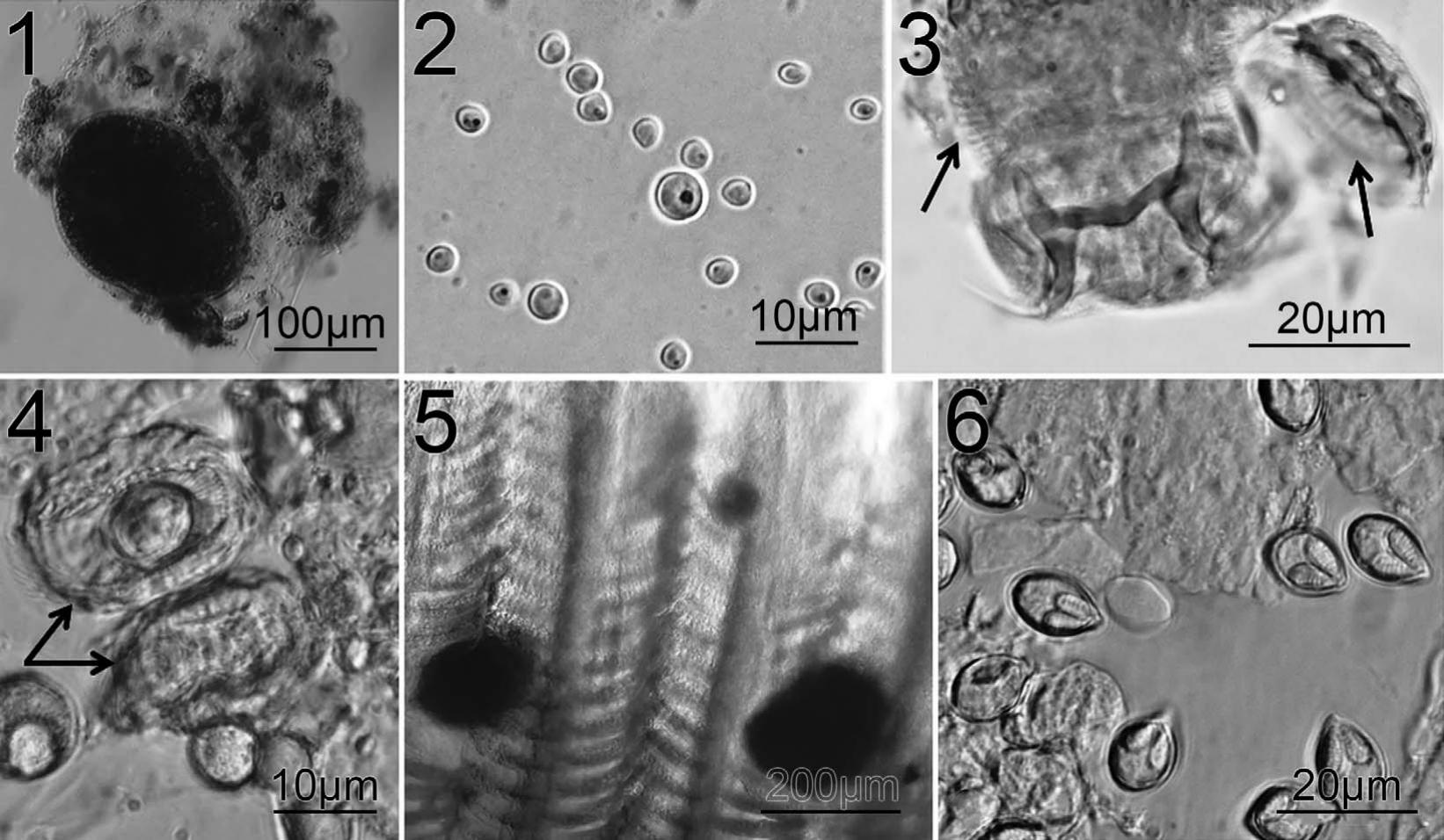 Gill Parasites of the Cypress Minnow, Hybognathus hayi Jordan ...
