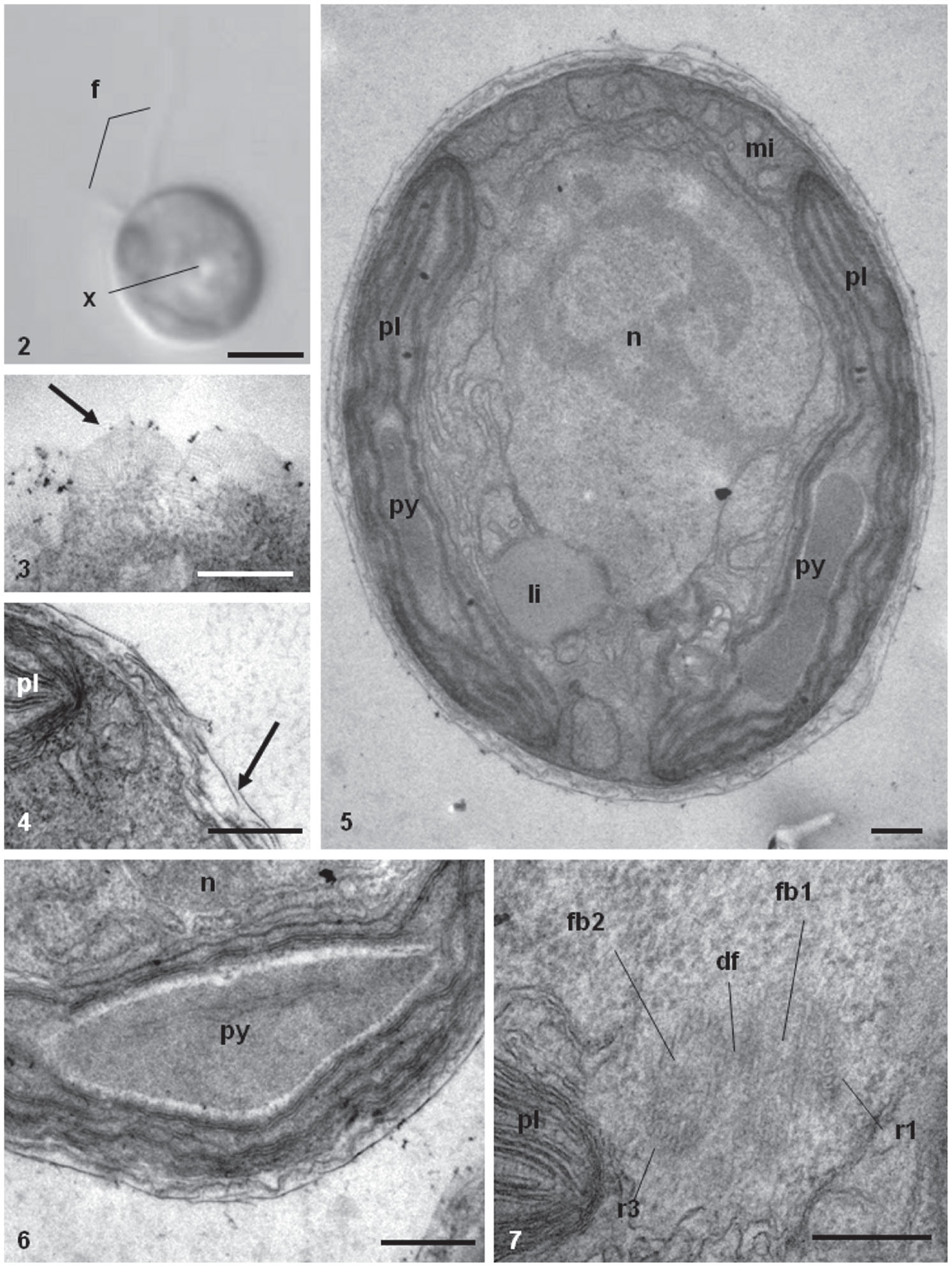 On the Ultrastructure of Gephyrocapsa oceanica (Haptophyta) Life Stages