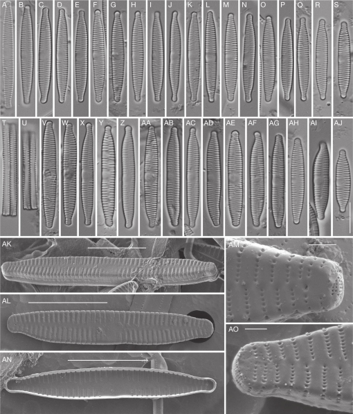 Analysis of the Type Material of Synedra deformis W.Sm. and Synedra ...