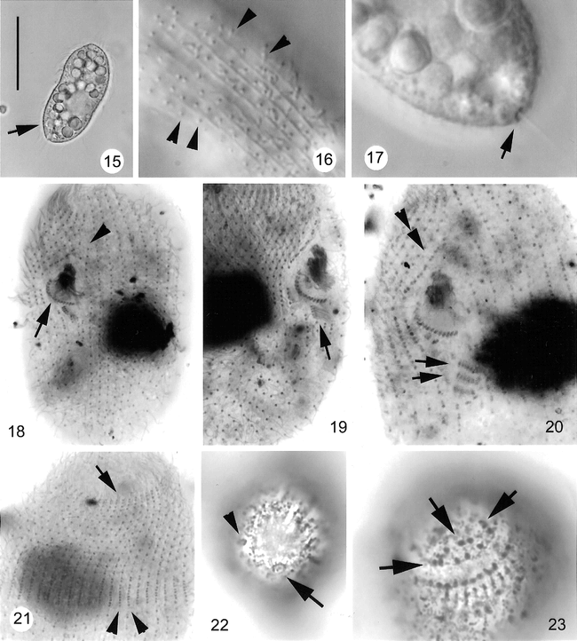 Dexiotrichides pangi n. sp. (Protozoa, Ciliophora, Scuticociliatia), a ...