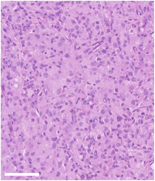 Oral histiocytic sarcoma in a cat