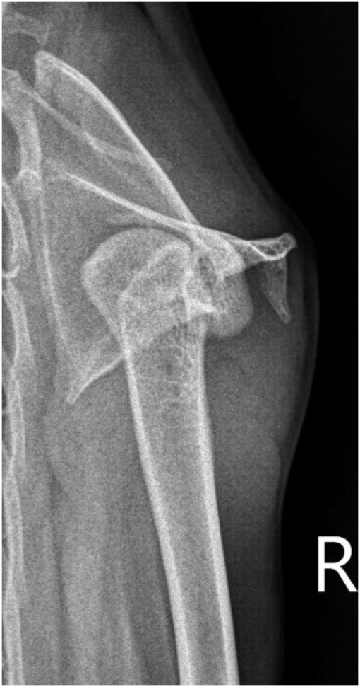 Novel prosthetic ligament repair of a shoulder luxation in a cat using ...