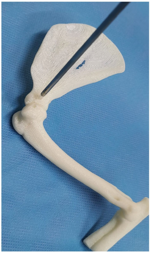 Novel prosthetic ligament repair of a shoulder luxation in a cat using ...