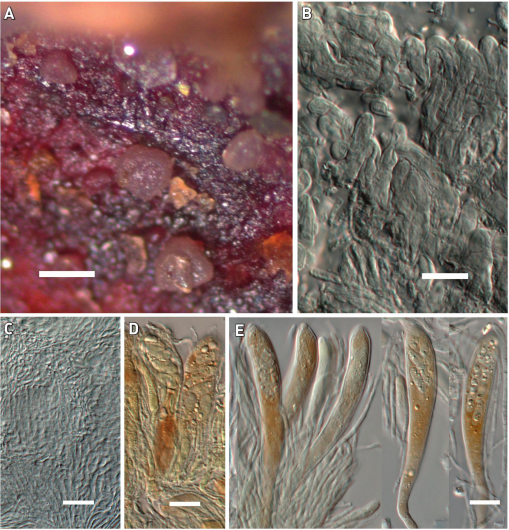 New species of lichenicolous fungi on Solorina