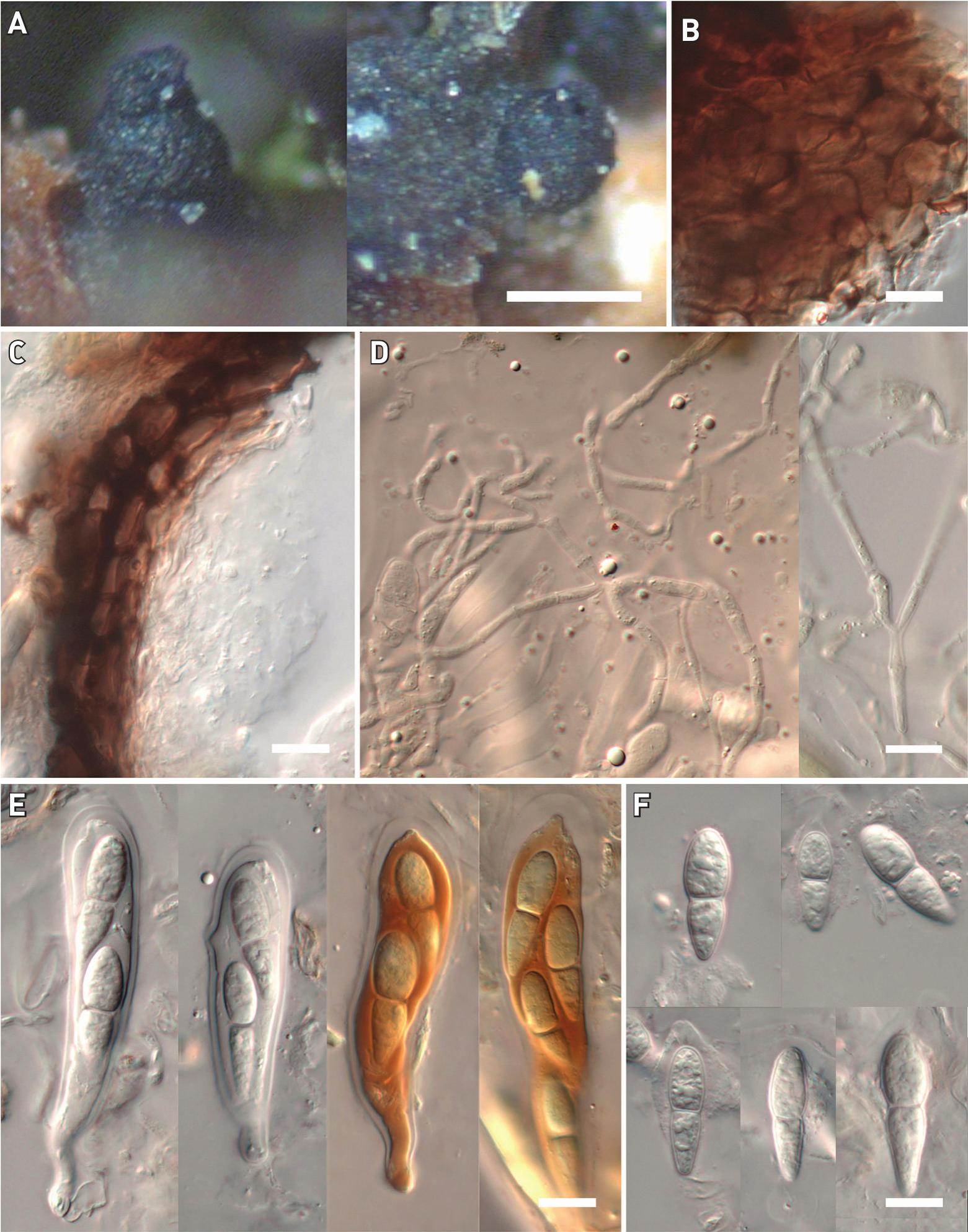 New species of lichenicolous fungi on Solorina