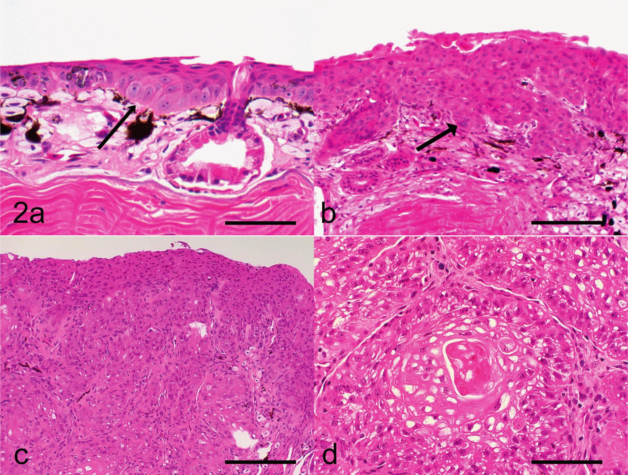 Squamous Cell Carcinoma in a Group of Solomon Island Leaf Frogs ...