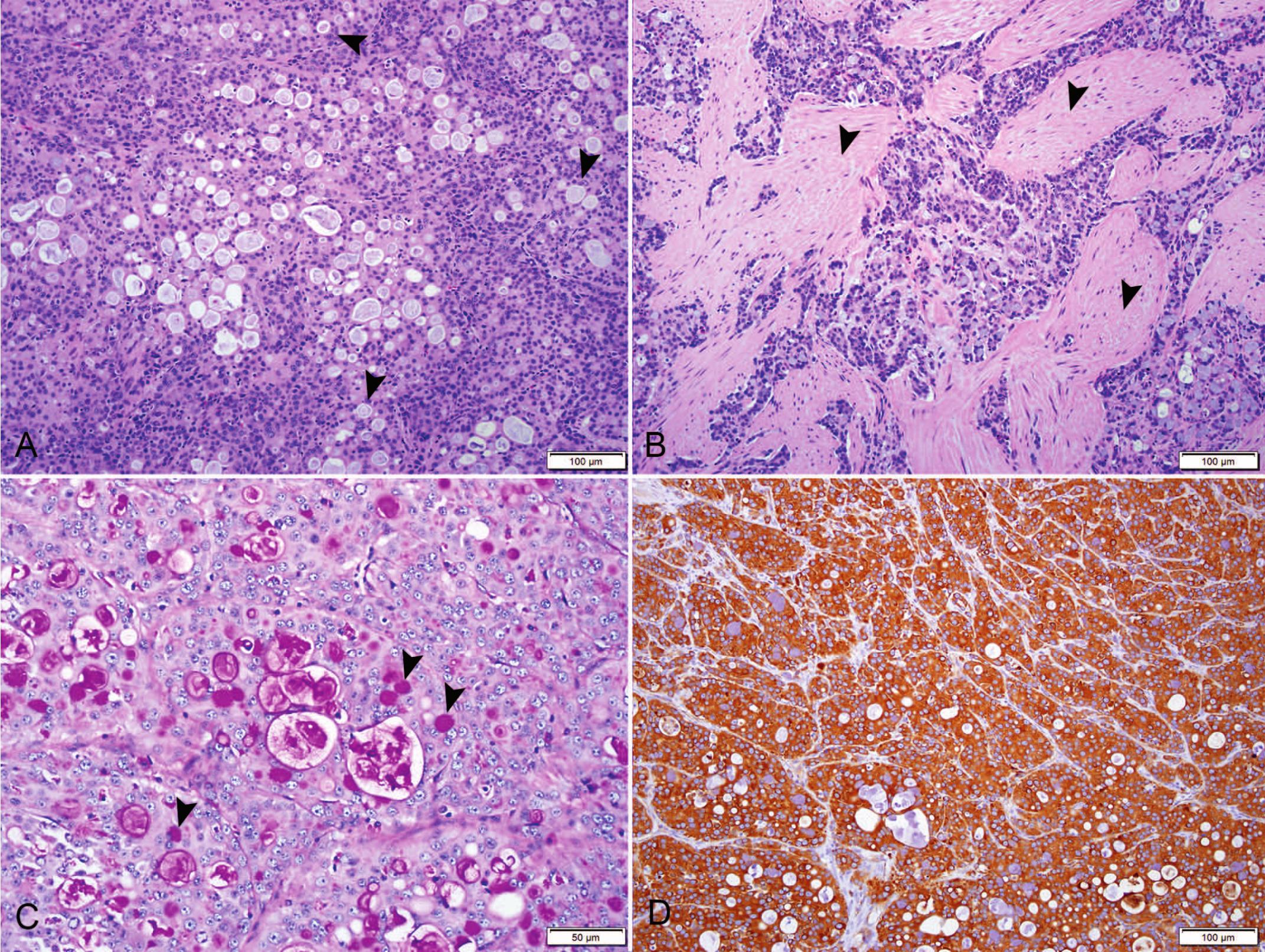 Intestinal Adenocarcinoma with Cloacal Prolapse and Reduction in a ...