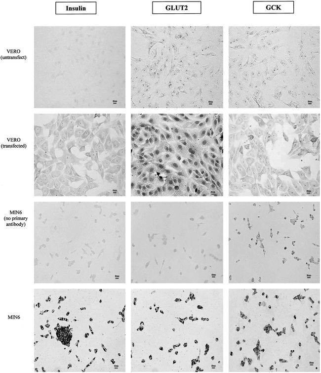 ENGINEERING VERO CELLS TO SECRETE HUMAN INSULIN