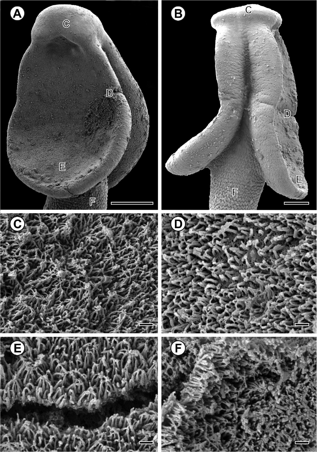 Comparative morphology of surface ultrastructure of diphyllobothriidean ...