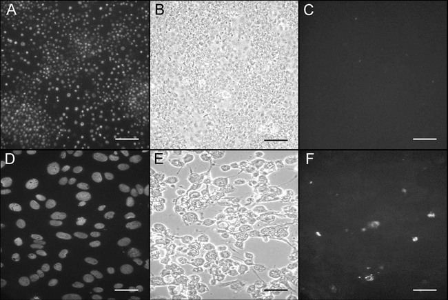 Vector Competence of Culicoides sonorensis (Diptera: Ceratopogonidae ...