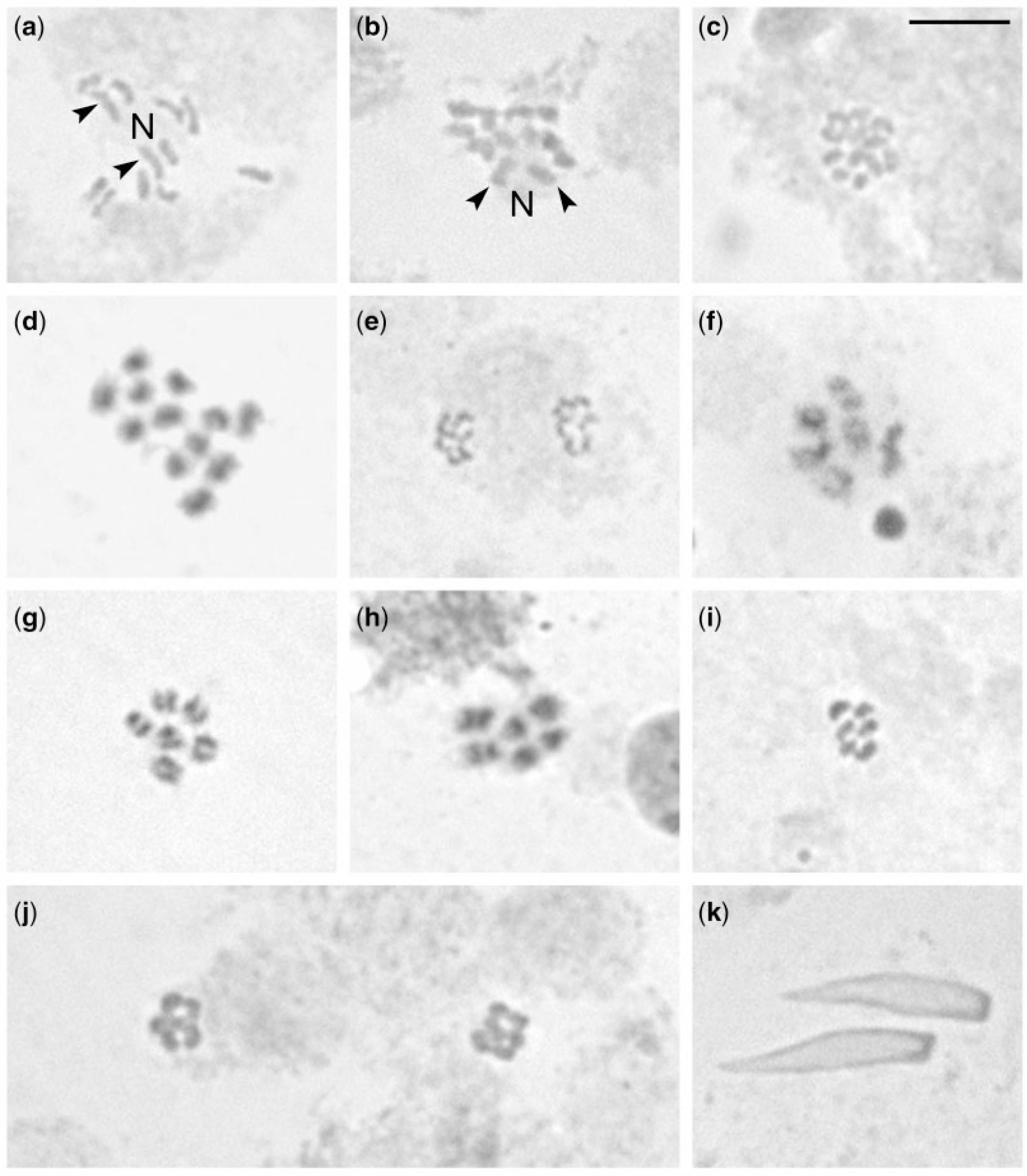 Cytogenetic Features of Human Head and Body Lice (Phthiraptera ...