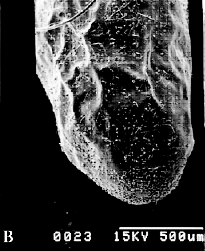 Scanning electron microscopy of egg-surface sculpturing of two common ...