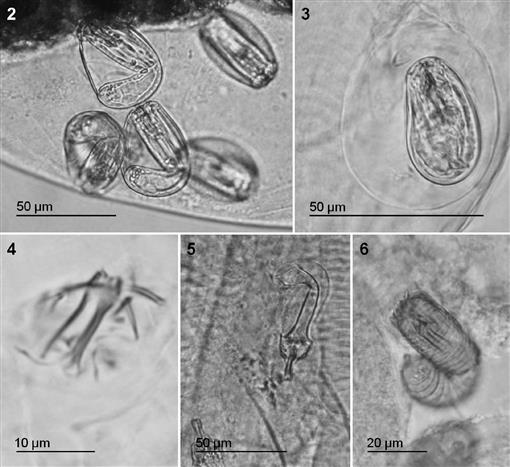 Horsehair Worm Microscope