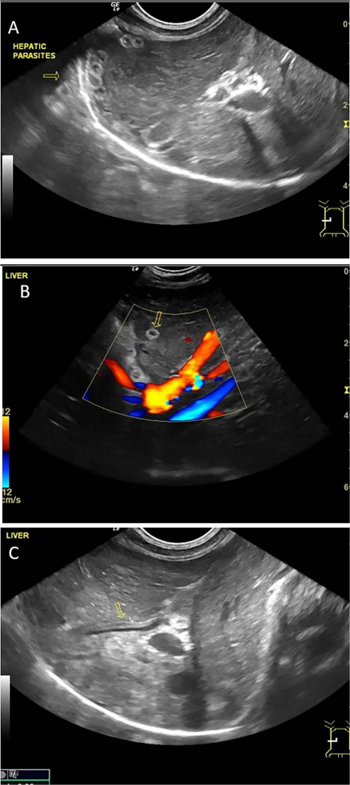 Giant Red Kidney Worm (Dioctophyma renale) Infection in Puppies Less ...