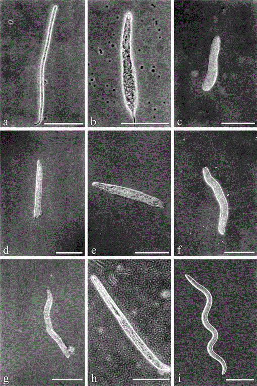 DEVELOPMENT OF ONCHOCERCA VOLVULUS (FILARIOIDEA: ONCHOCERCIDAE) IN THE ...