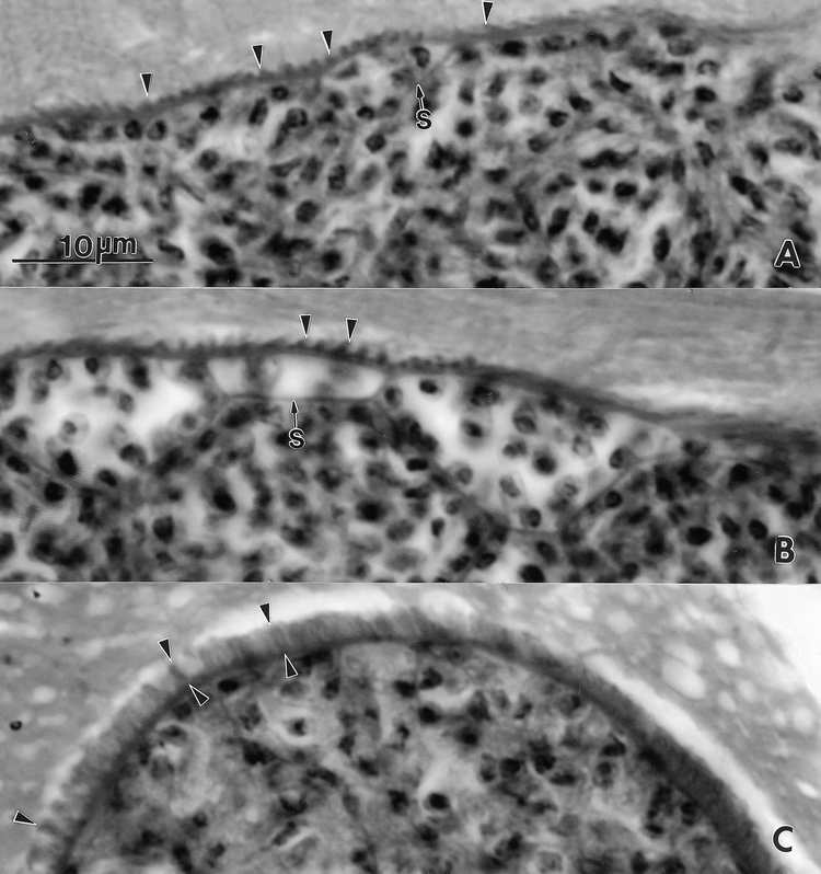 A New Species of Sarcocystis (Apicomplexa: Sarcocystidae) from the ...