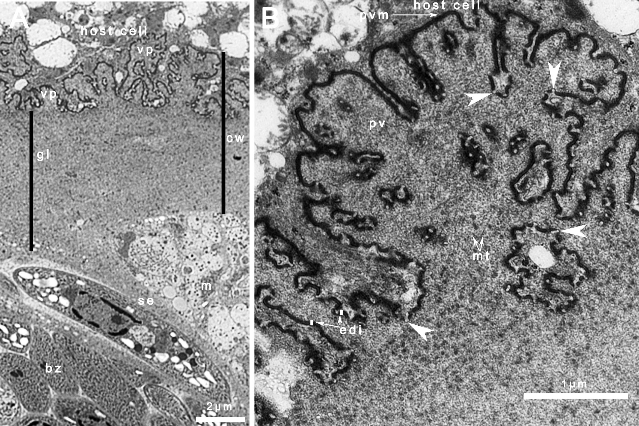 Morphologic and Molecular Characterization of the Sarcocysts of ...