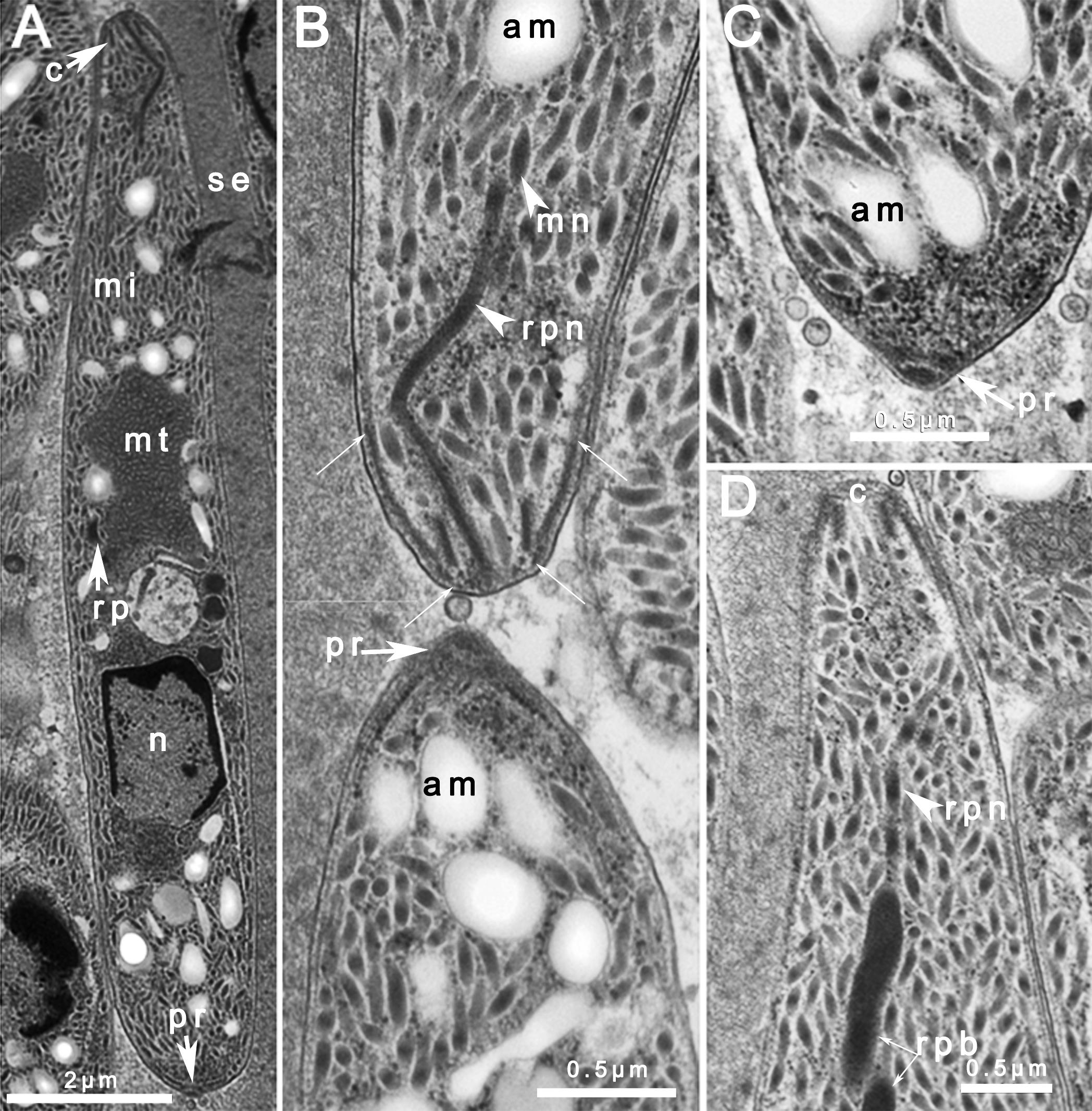 Morphologic and Molecular Characterization of the Sarcocysts of ...