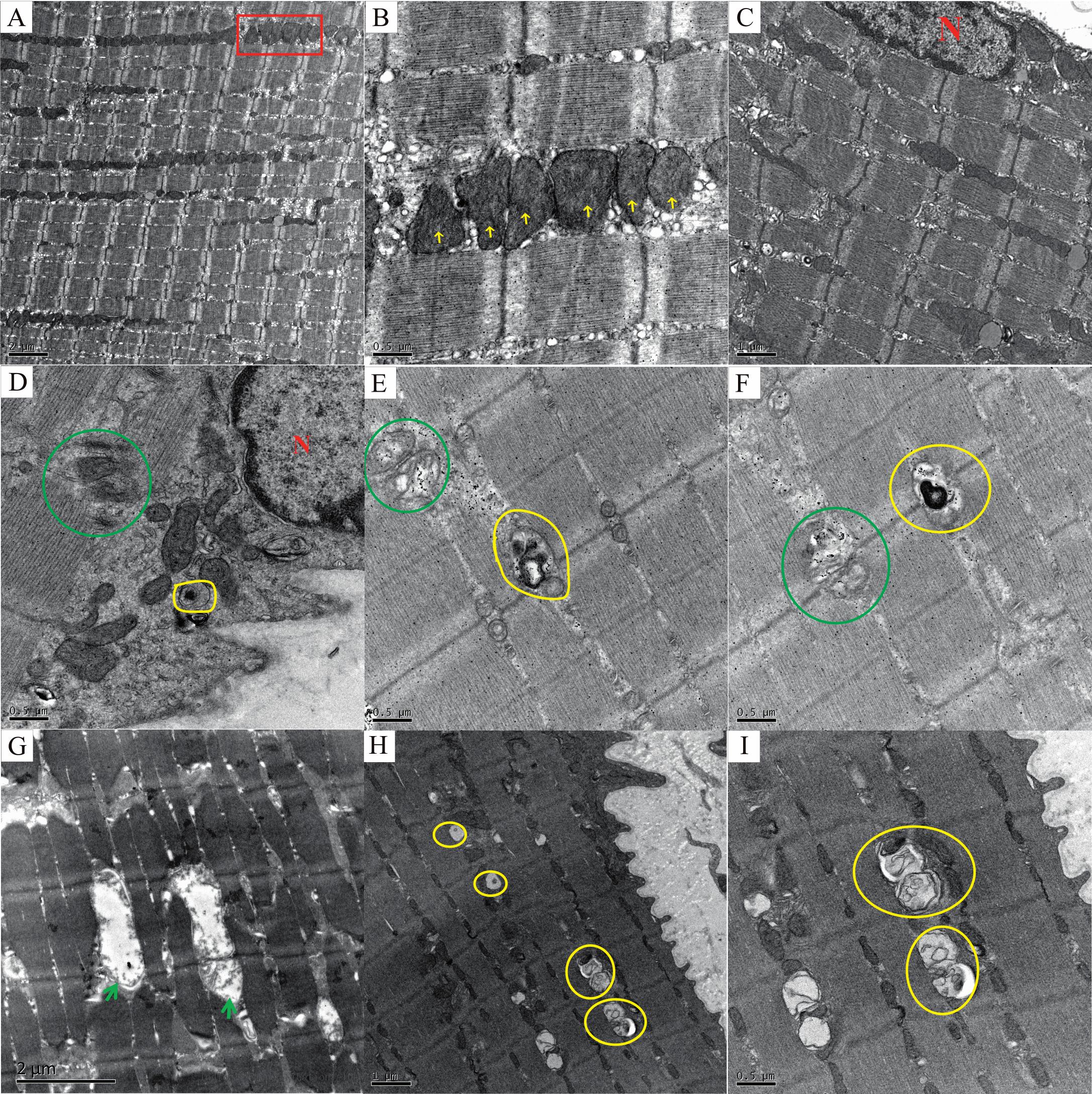Satellite Cells are Activated in a Rat Model of Radiation-Induced ...