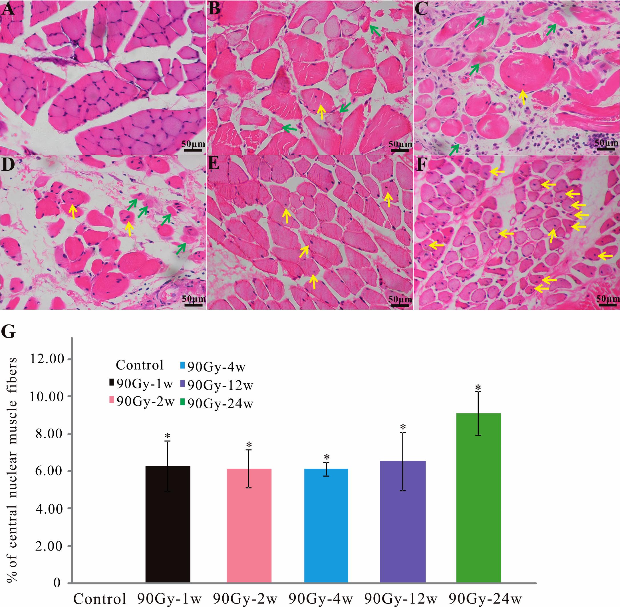 Satellite Cells are Activated in a Rat Model of Radiation-Induced ...