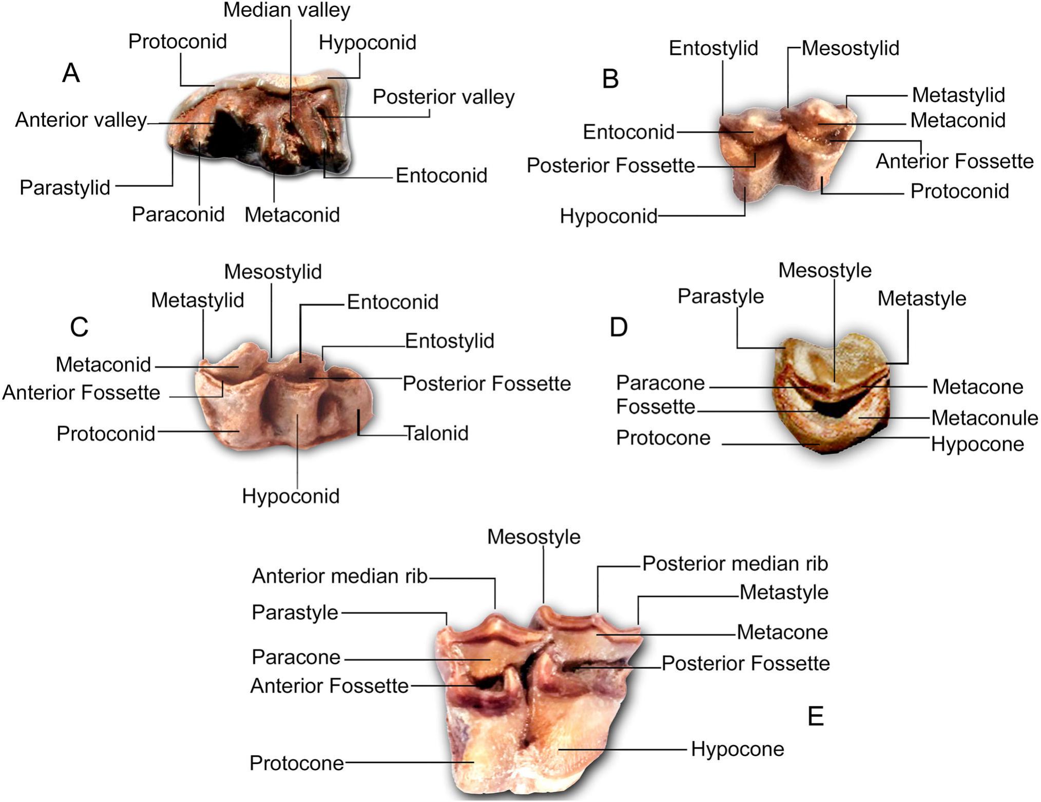 New Sivatheriine Giraffid (Ruminantia, Mammalia) Craniodental Material ...