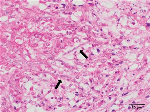 DISSEMINATED OPHIDIOMYCES OPHIODIICOLA INFECTION IN A CAPTIVE EASTERN ...