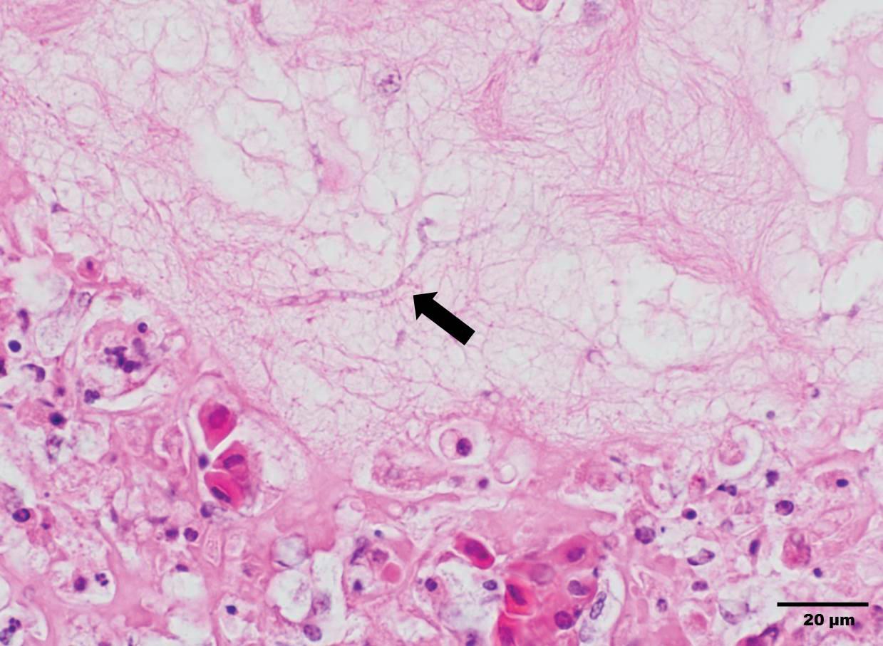 DISSEMINATED OPHIDIOMYCES OPHIODIICOLA INFECTION IN A CAPTIVE EASTERN ...