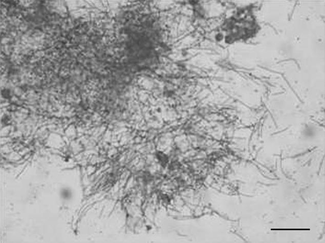 FIRST ISOLATION OF TENACIBACULUM MARITIMUM IN A CAPTIVE SAND TIGER ...